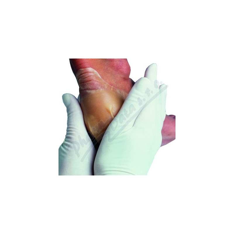 Hydrocoll Concave wound dressings
