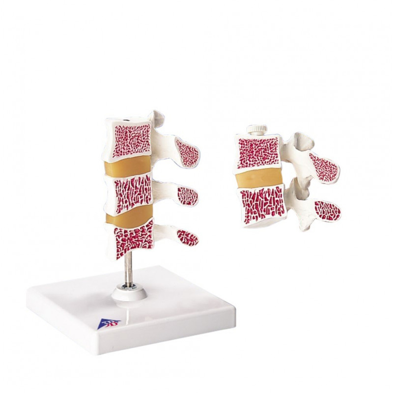 3B Scientific A78 deluxe osteoporos | Medi-Shop.gr