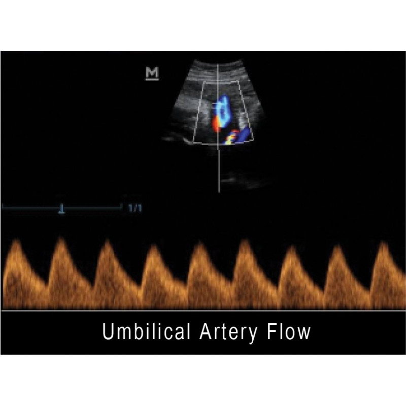 Mindray Z5 colour Ultrasound Diagnostic System | Medi-Shop.gr
