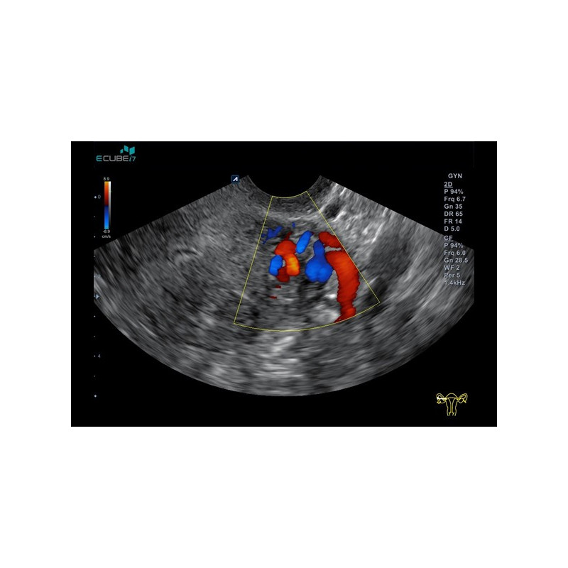 Alpinion E-Cube i7 portable ultrasound | Medi-Shop.gr