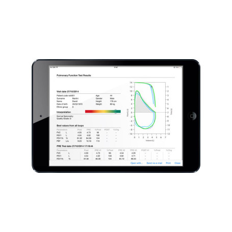 MIR Spirobank II Smart spirometer with 60 FlowMIR turbines | Medi-Shop.gr