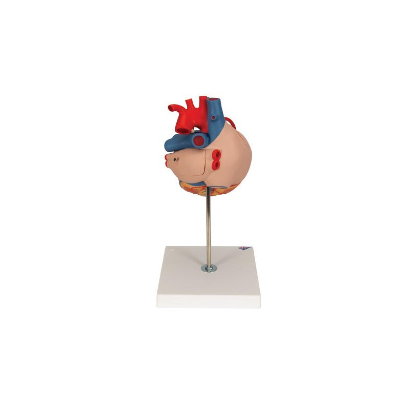3B Scientific 4-part heart model with Bypass | Medi-Shop.gr