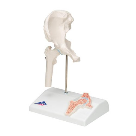 3B scientific mini hip joint model with cross section | Medi-Shop.gr