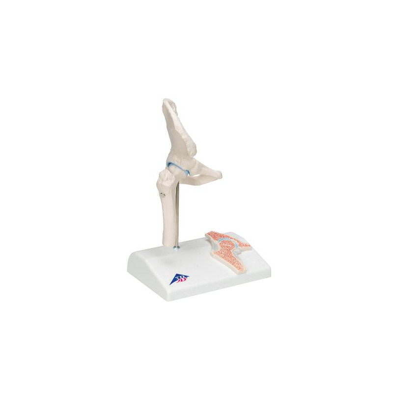 3B scientific mini hip joint model with cross section | Medi-Shop.gr
