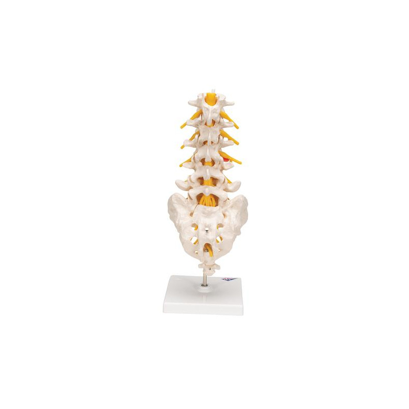 3B Scientific lumbar spinal column model with prolapsed intervertebral ...