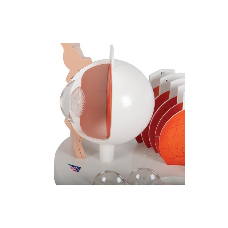 3B Scientific large size eye pathology model | Medi-Shop.gr