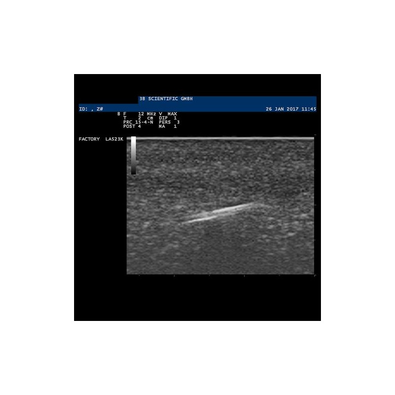 Πρόπλασμα δέρματος με 6 ξένα σώματα για υπερηχογράφο 3B Scientific ...