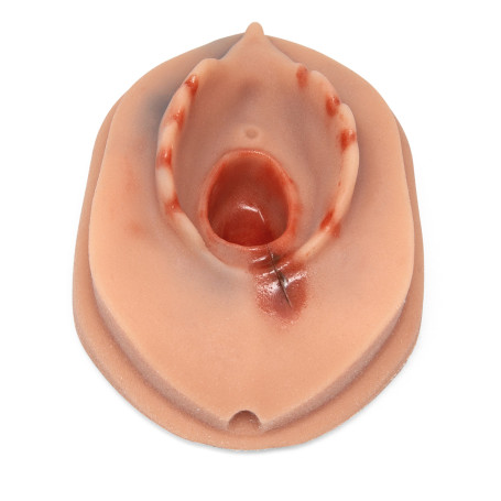 3B Scientific episiotomy suture training module for birthing simulator P90 light skin | Medi-Shop.gr