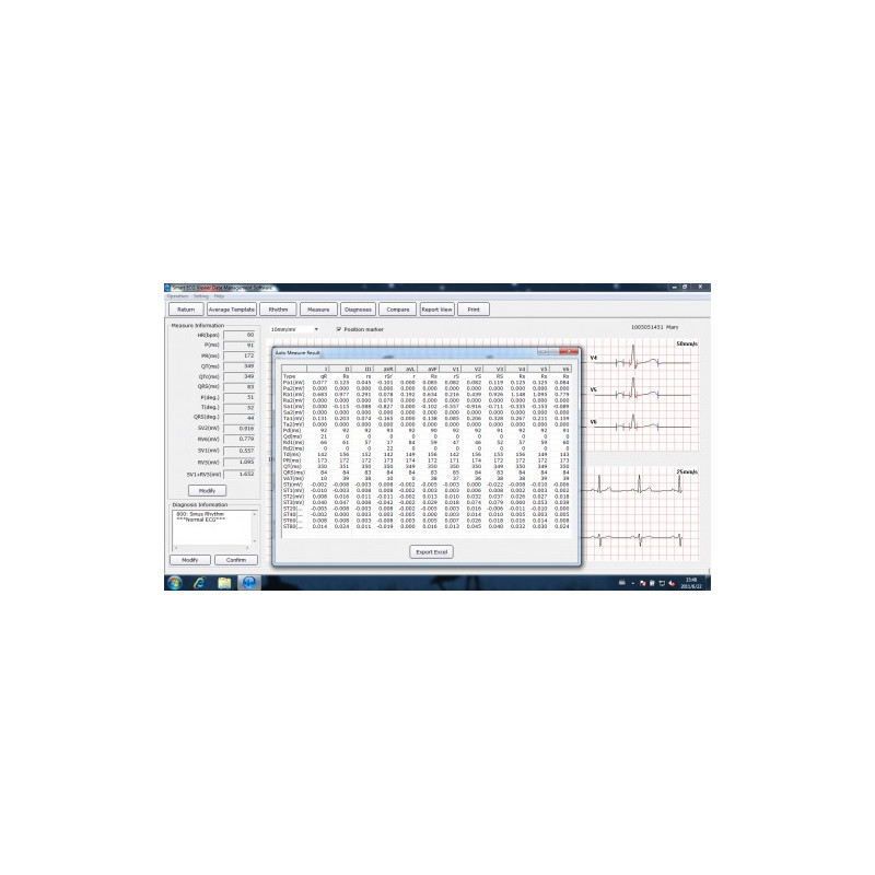 Smart ECG Viewer PC Software | Medi-Shop.gr