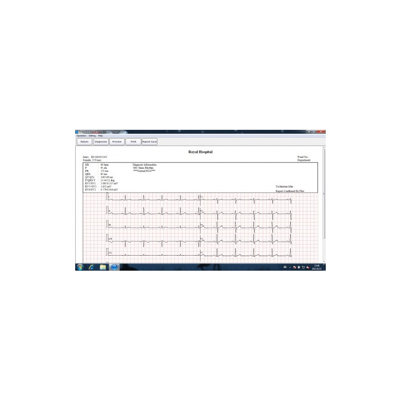 Smart ECG Viewer PC Software | Medi-Shop.gr